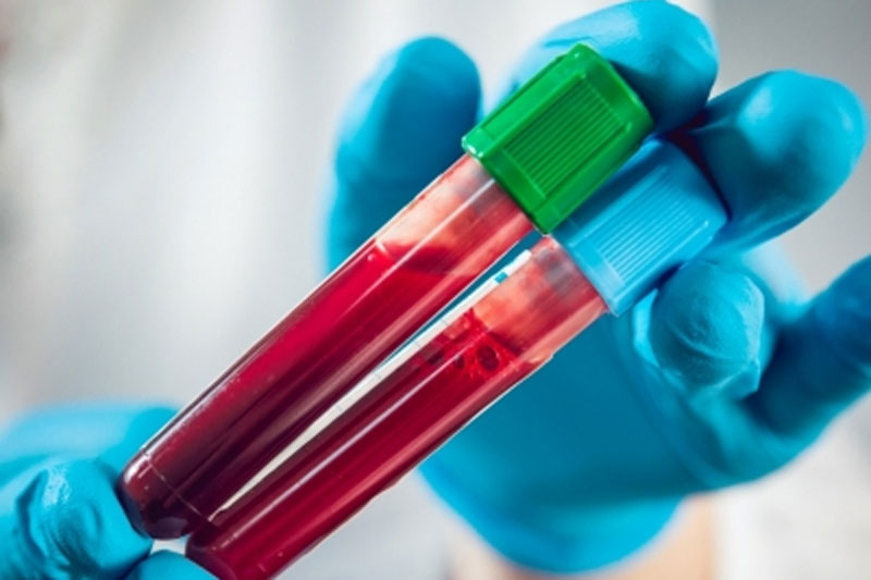 Anxious About Anxiety Now A Simple Blood Test May Help Detect It Anxious About Anxiety Now A Simple Blood Test May Help Detect It
